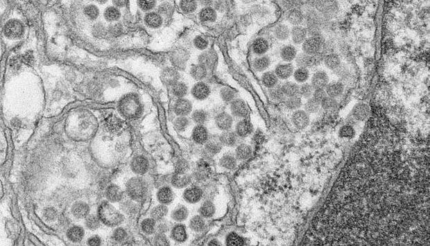 Camel flu is at the centre of MERS outbreaks - News - Nature Middle East