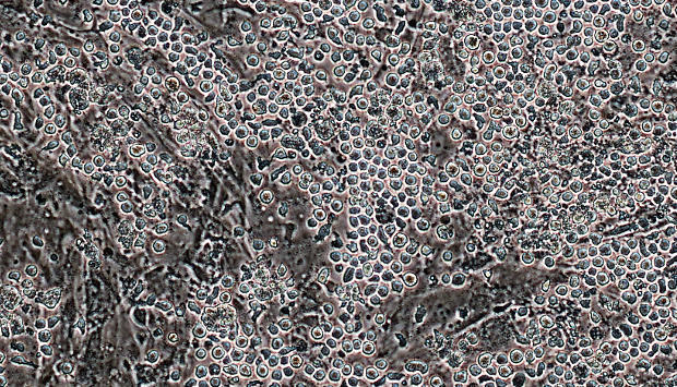 Lab-grown blood stem cells - News - Nature Middle East