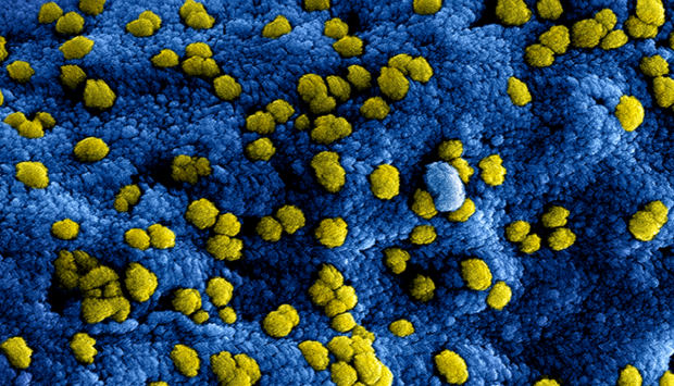 Scrutinizing MERS immune response - News - Nature Middle East